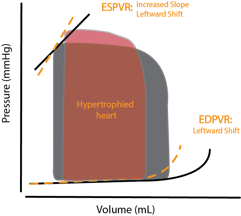 Cardiac Hypertrophy Research | Ventricular Pressure-Volume (PV) Analysis | ADInstruments